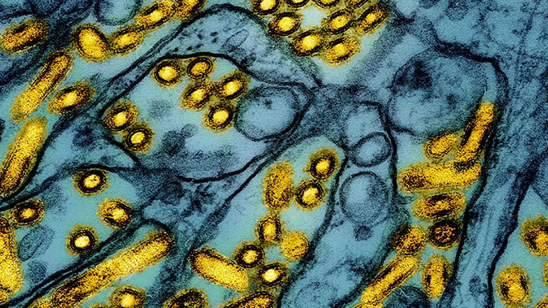 CDC bird flu update: Study prompts call for more testing on farms ...