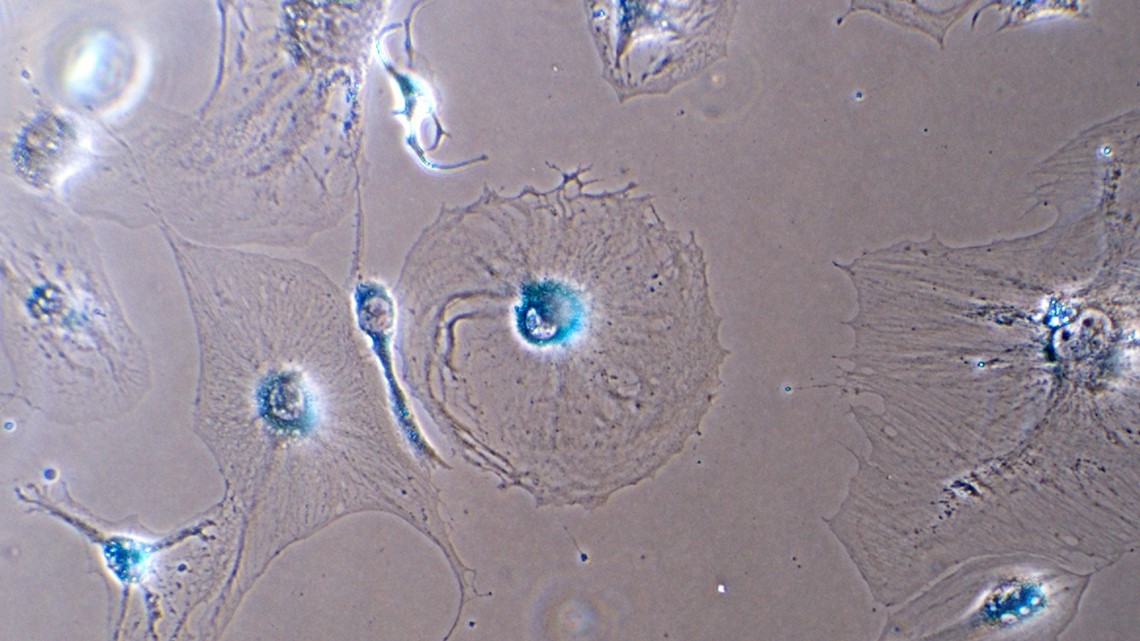 Zombie cells, or cellular senescence, key in age research | 11alive.com