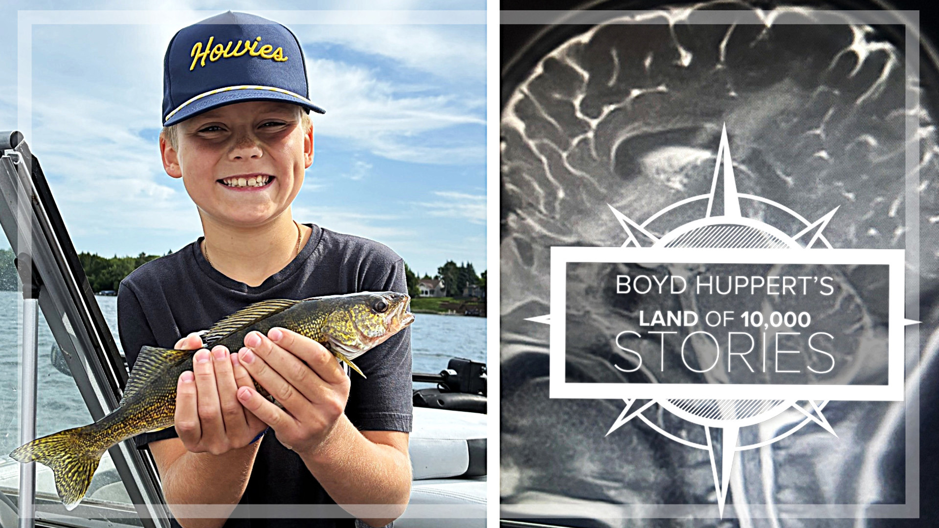 9-year-old MN boy survives arrow through his brain | 11alive.com