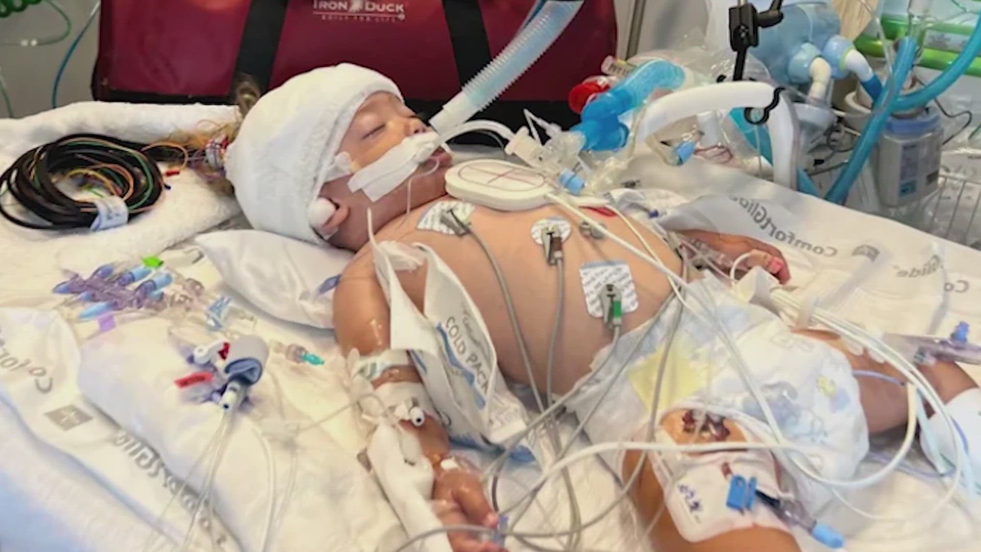Toddler survives near drowning | Houston news | 11alive.com