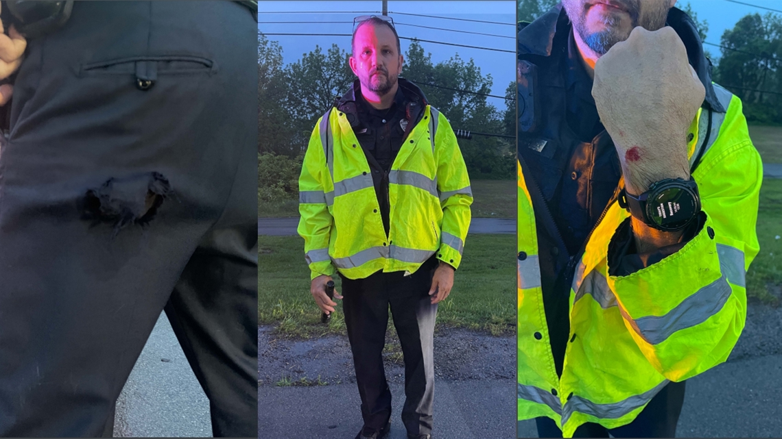 PHOTOS: LMPD officer's injuries after Scottie Scheffler arrest ...