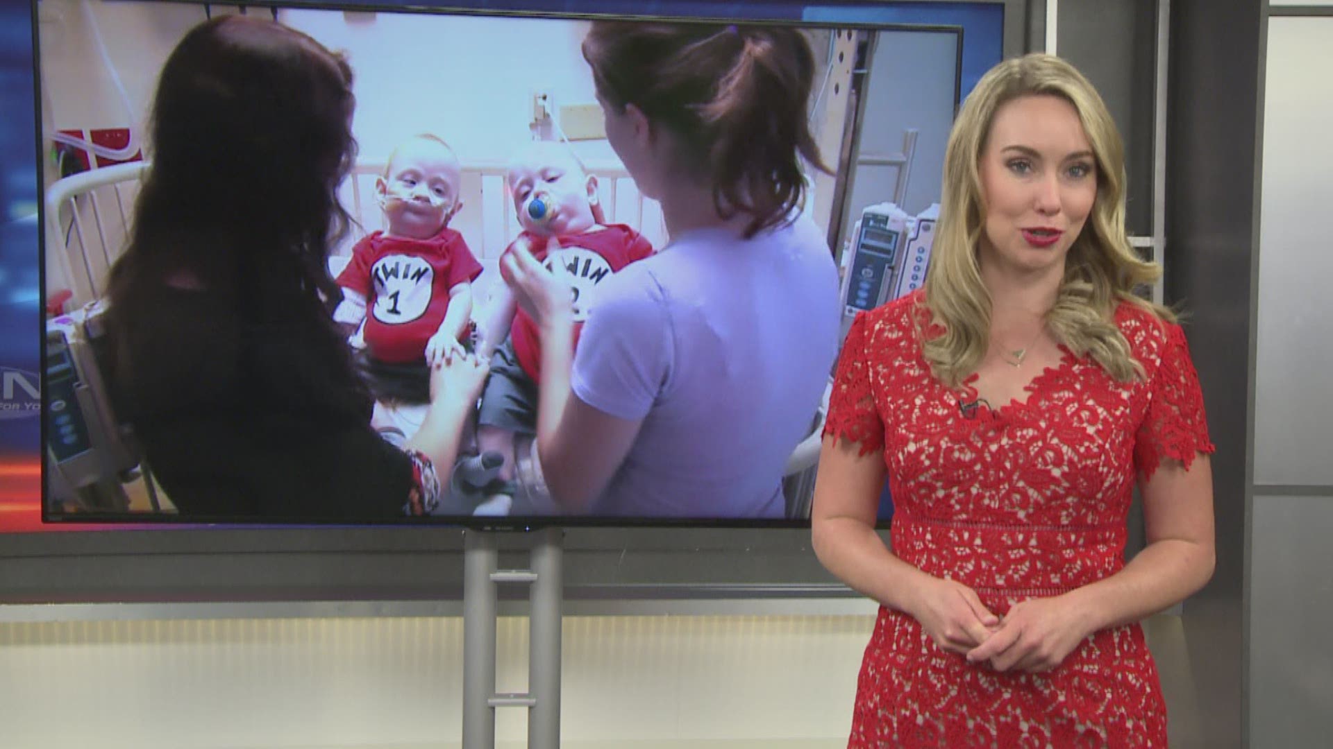 Formerly conjoined twins, Carter & Conner, go trick-or-treating ...