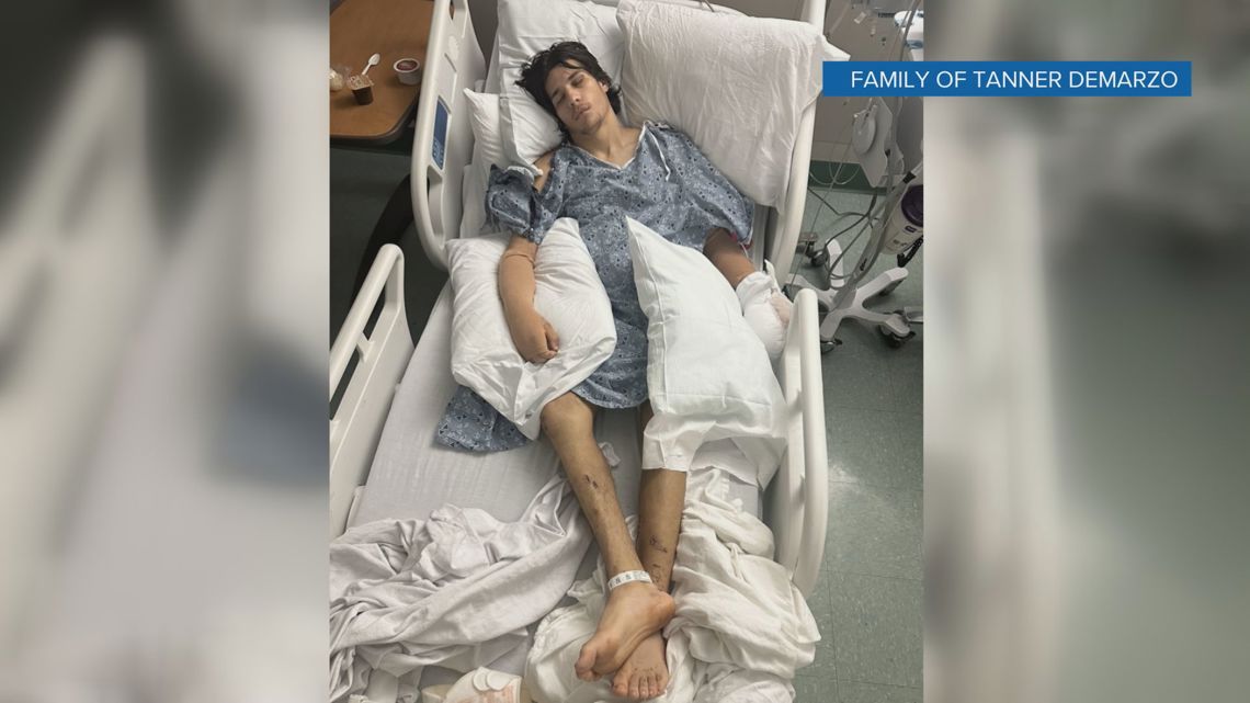 Teen motorcycle crash survivor thanks medics who saved his life ...
