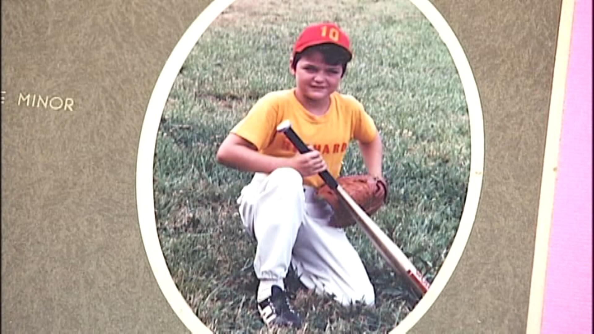 After surviving first-ever face transplant, man needs another medical ...