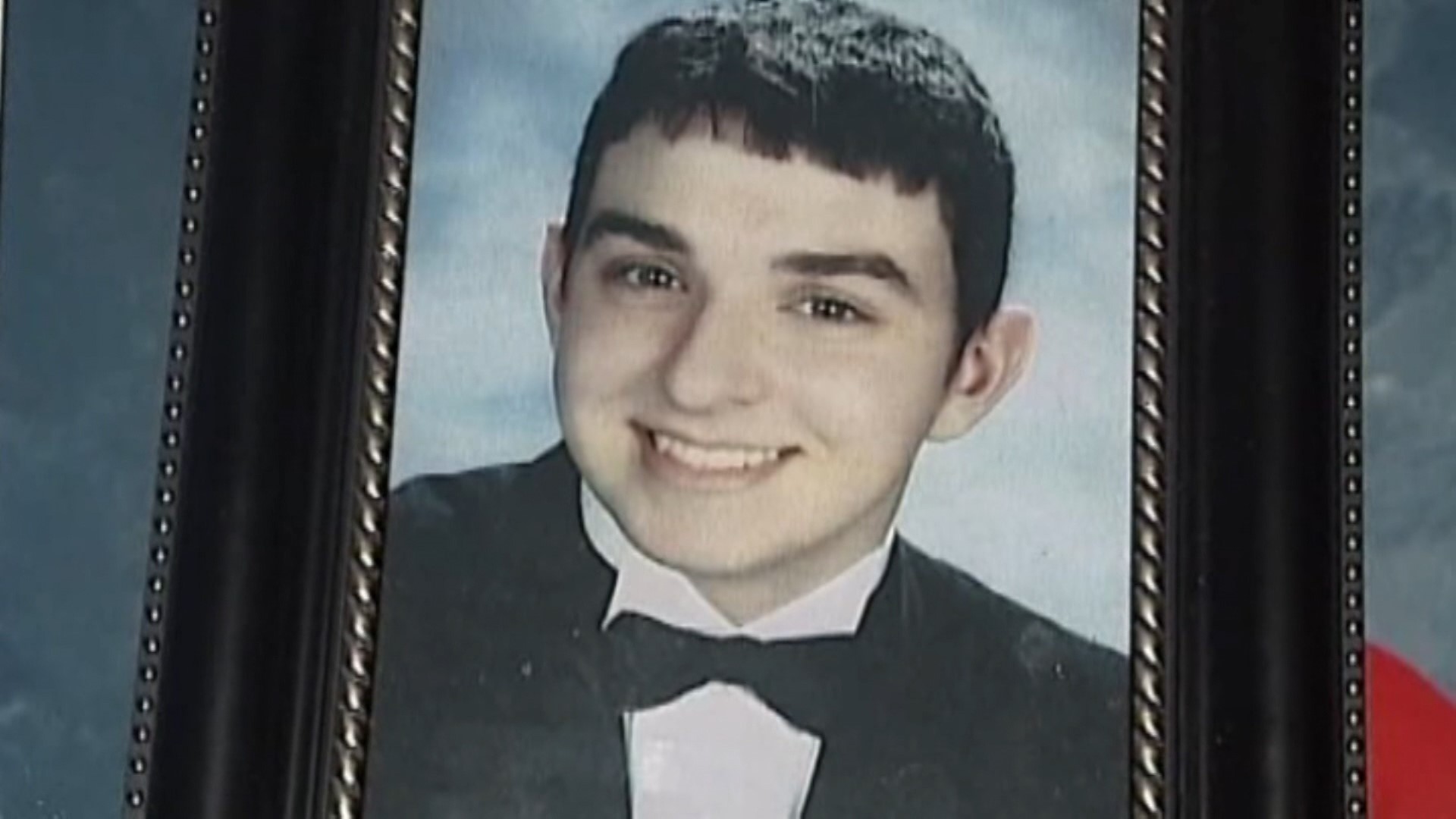 After surviving first-ever face transplant, man needs another medical ...