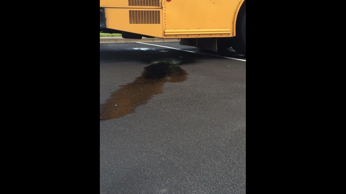 Warning: Graphic photos show student's burns from school bus | 11alive.com