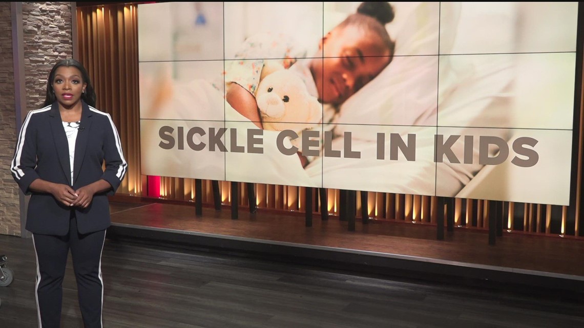 CDC issues warning about sickle cell disease in kids | 11alive.com