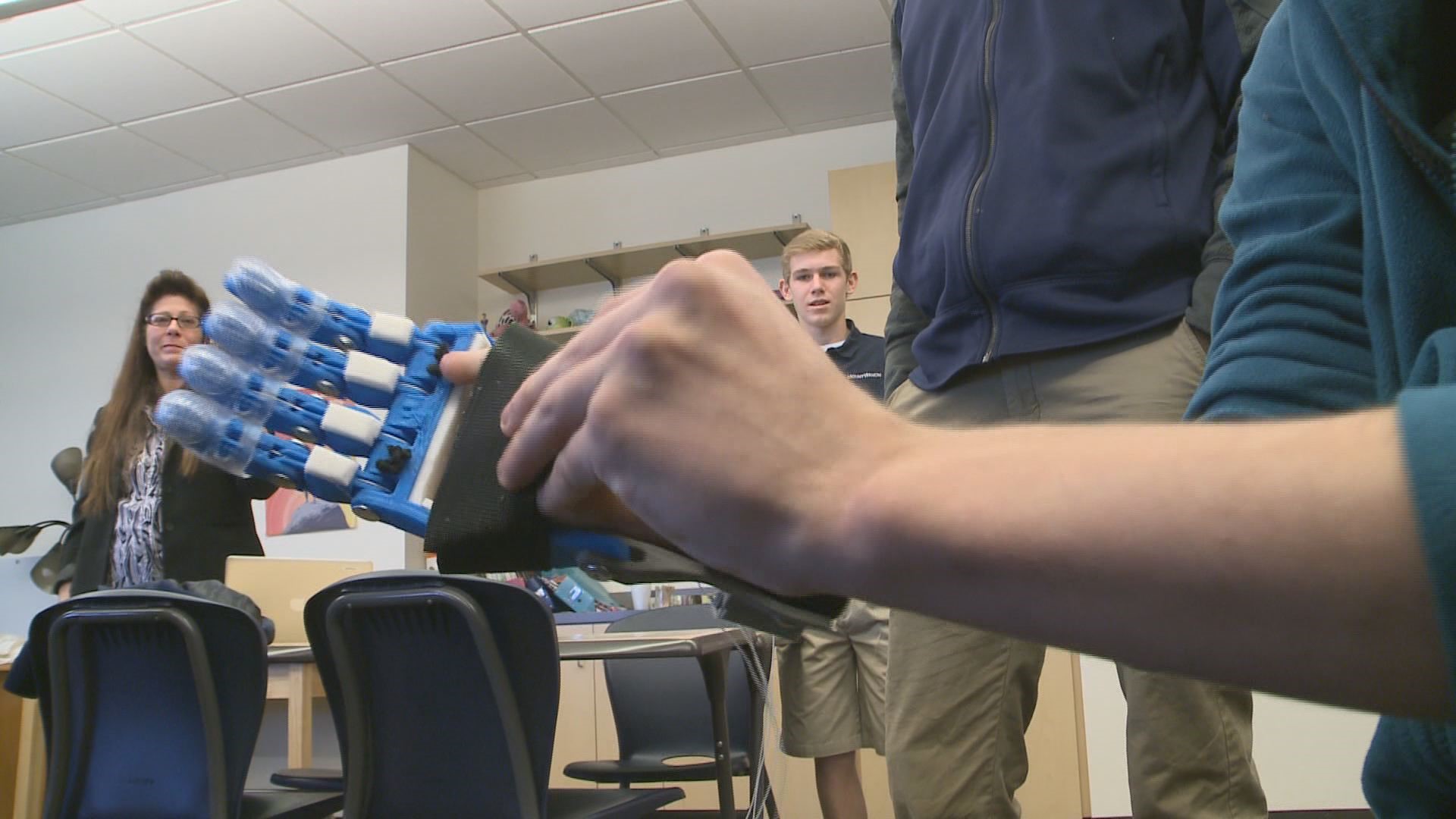 High school students make prosthetic hand for teen | 11alive.com