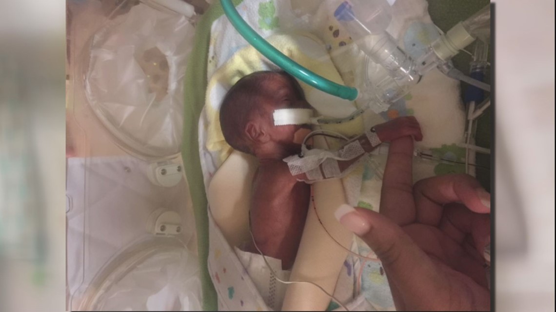 Tiny Miracle Baby Proves Size Doesn’t Matter | 11alive.com