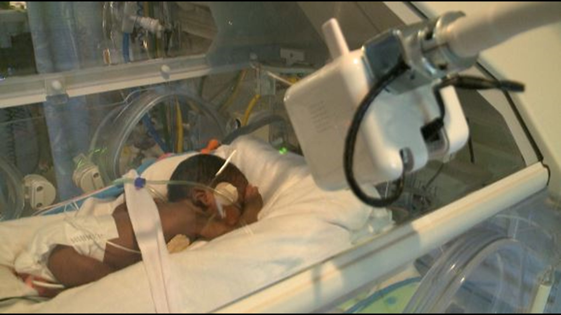 Hospital offers live NICU cameras for parents and patients | 11alive.com
