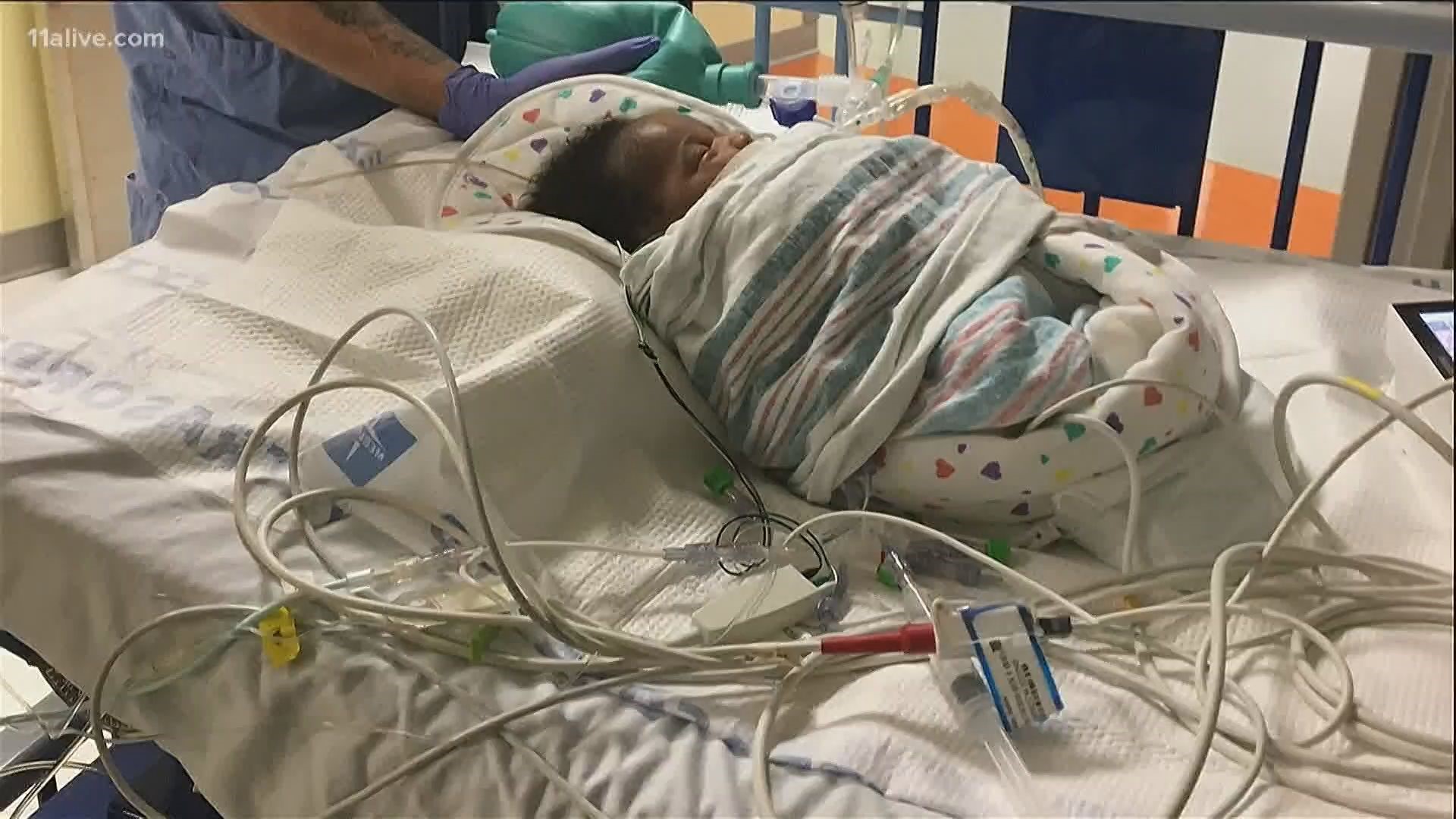 Innovative surgery for babyJustice Altidor, | 11alive.com