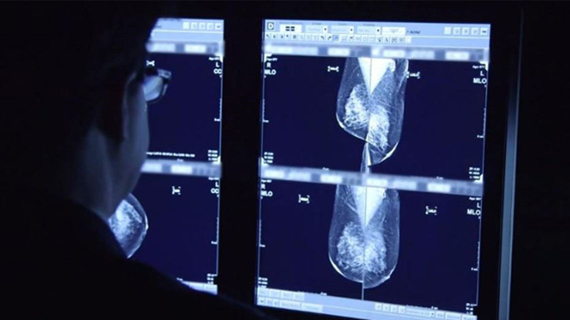 3D mammogram technology better for women with dense breasts | 11alive.com