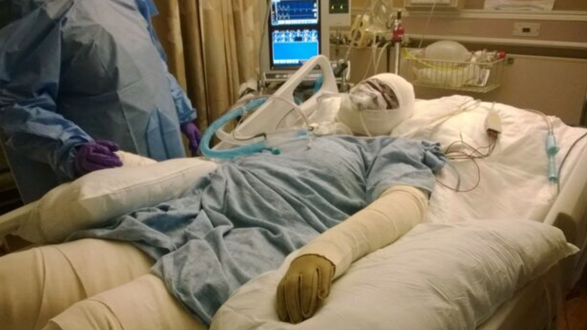 Woman's skin 'melts off' after medication error | 11alive.com