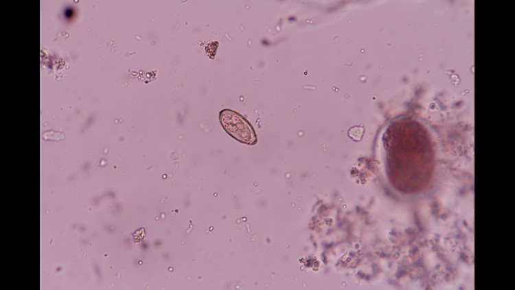 Does parasitic worm spit contain the key to healing? | 11alive.com