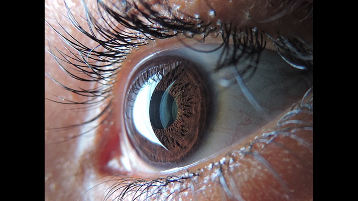 'Eclipse blindness' is a real thing. Here's how to watch the solar ...