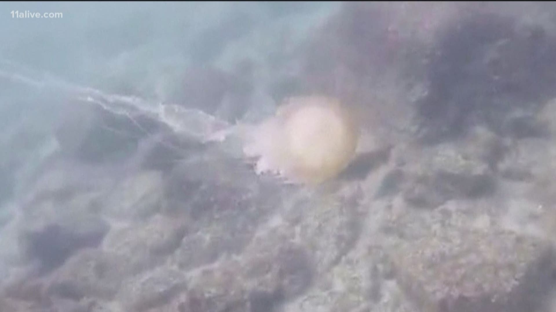 Stinging sea lice lead to warning flags at Florida beach | 11alive.com