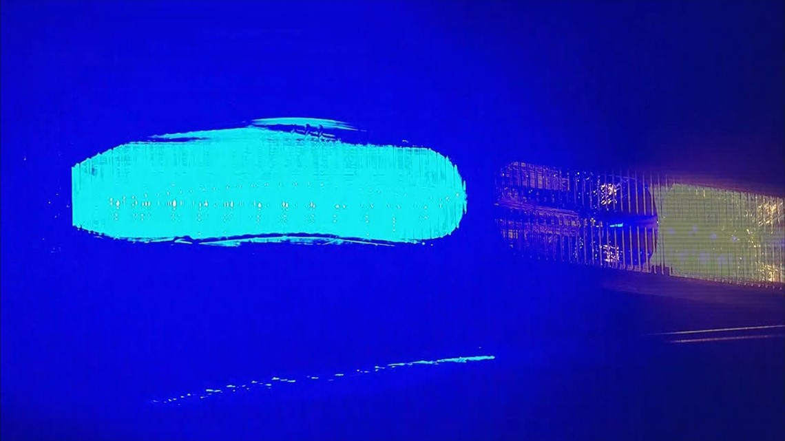 Woman goes to hospital for headache, doctors find bullet in skull ...