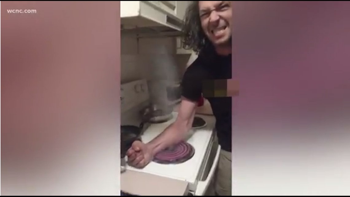 'Hot coil challenge' newest, dangerous fad | 11alive.com