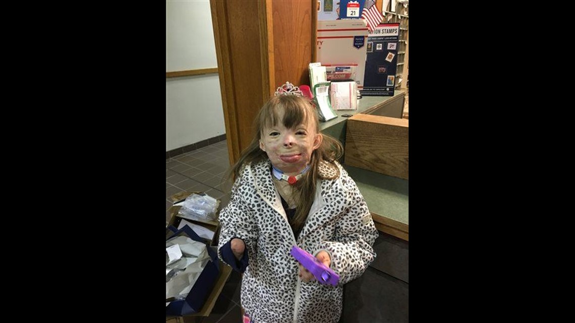 8-year-old burn victim surprised with a trip to Disney | 11alive.com