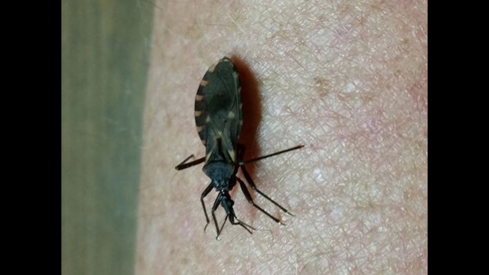 Kissing bug | What you should know about Chagas disease | 11alive.com