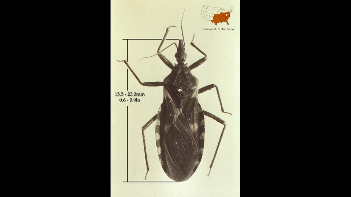 Kissing bug | What you should know about Chagas disease | 11alive.com