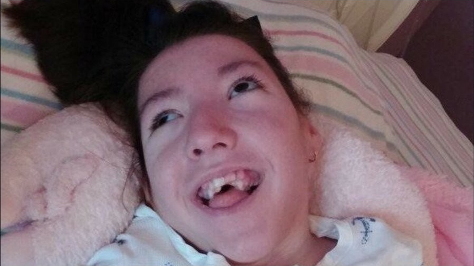 Years later, meningitis survivor continues to battle physical ...