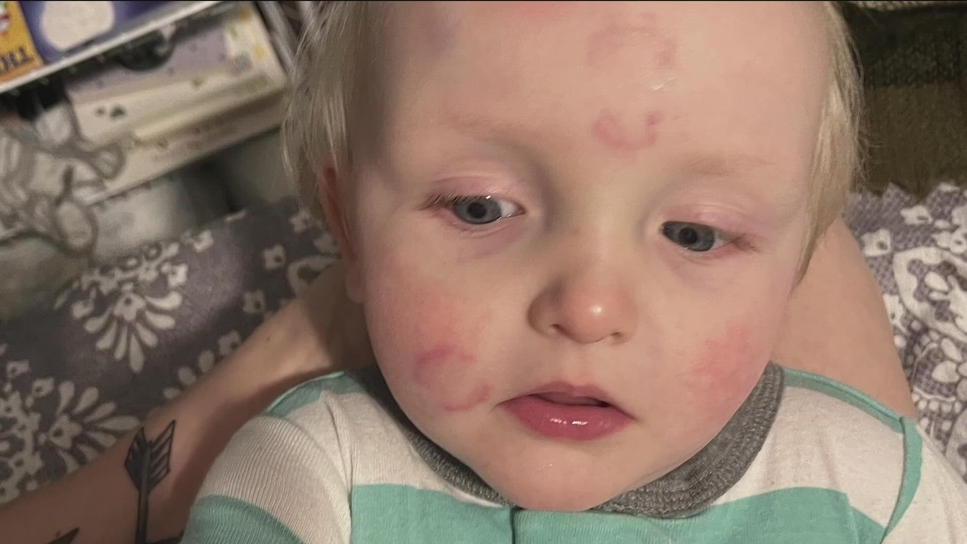 Investigation underway after child bitten at Clayton County daycare ...