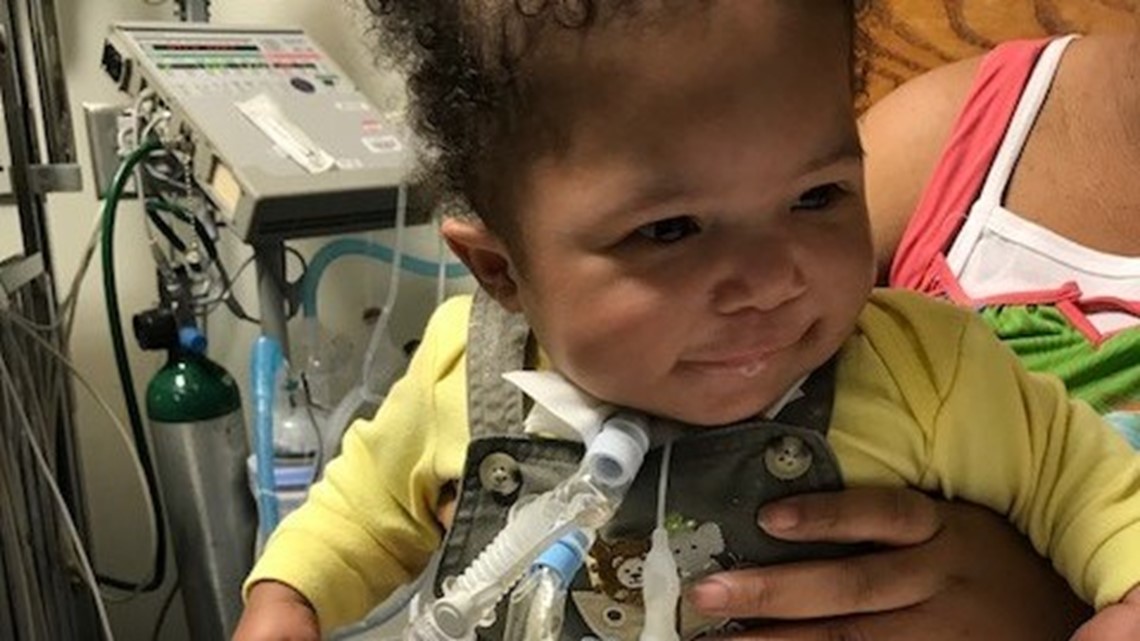 PHOTOS | Children's Healthcare of Atlanta first-ever 3D-printed ...