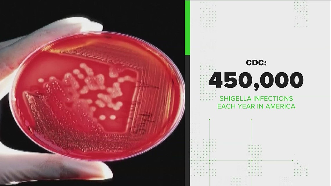 What doctors say you need to know about Shigella, the drug-resistant ...