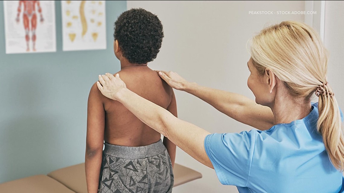Why are doctors seeing more cases of scoliosis in kids? | 11alive.com