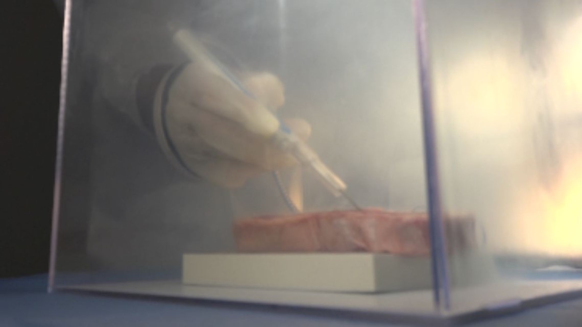 Nurses, surgeons and techs deal with hazards of surgical smoke ...