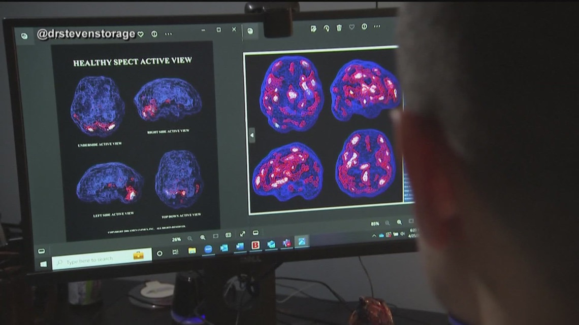 More women being prescribed ADHD medication | Here's why | 11alive.com