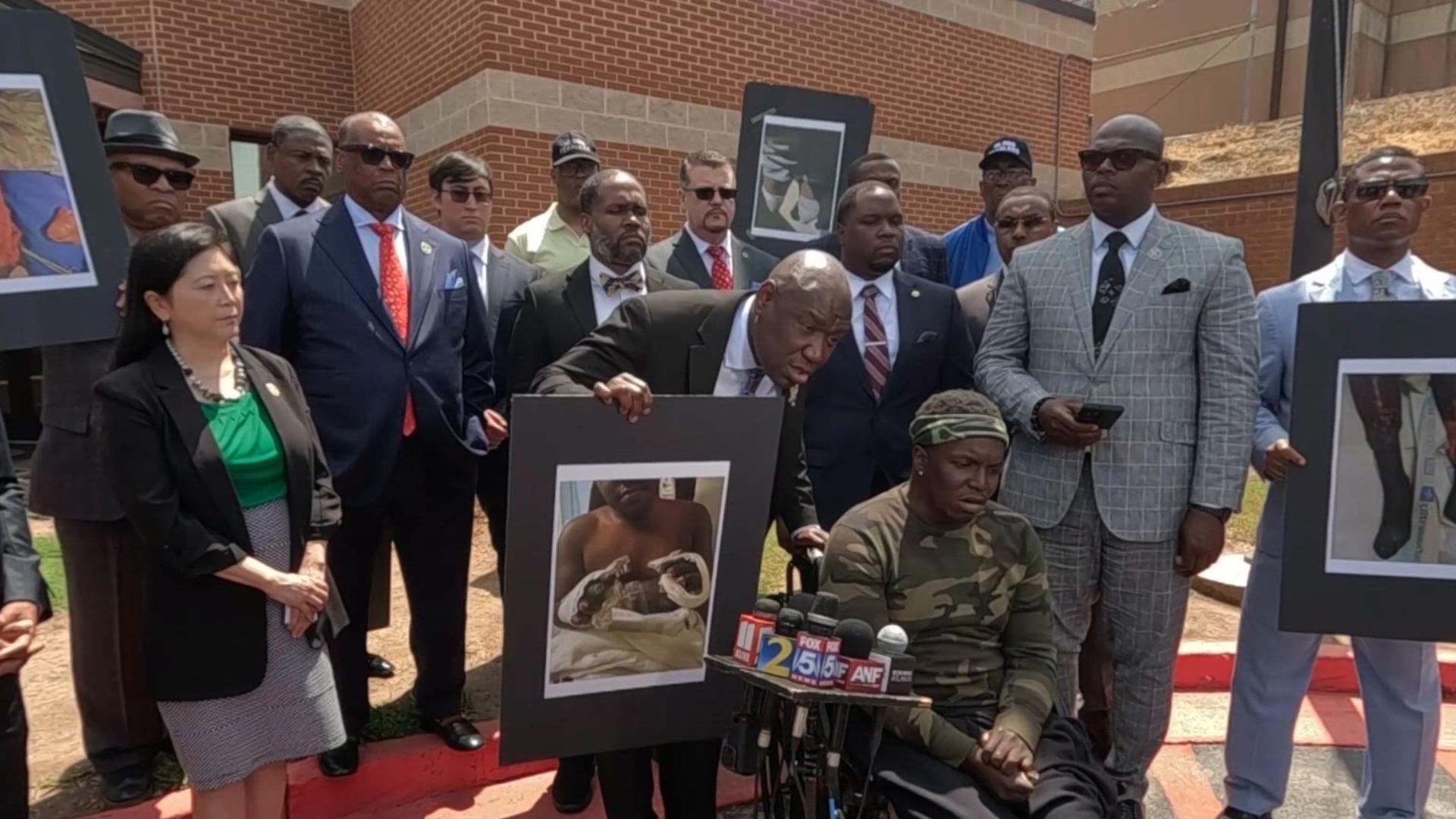 Man loses limbs after he says he was denied medical care in Fulton ...