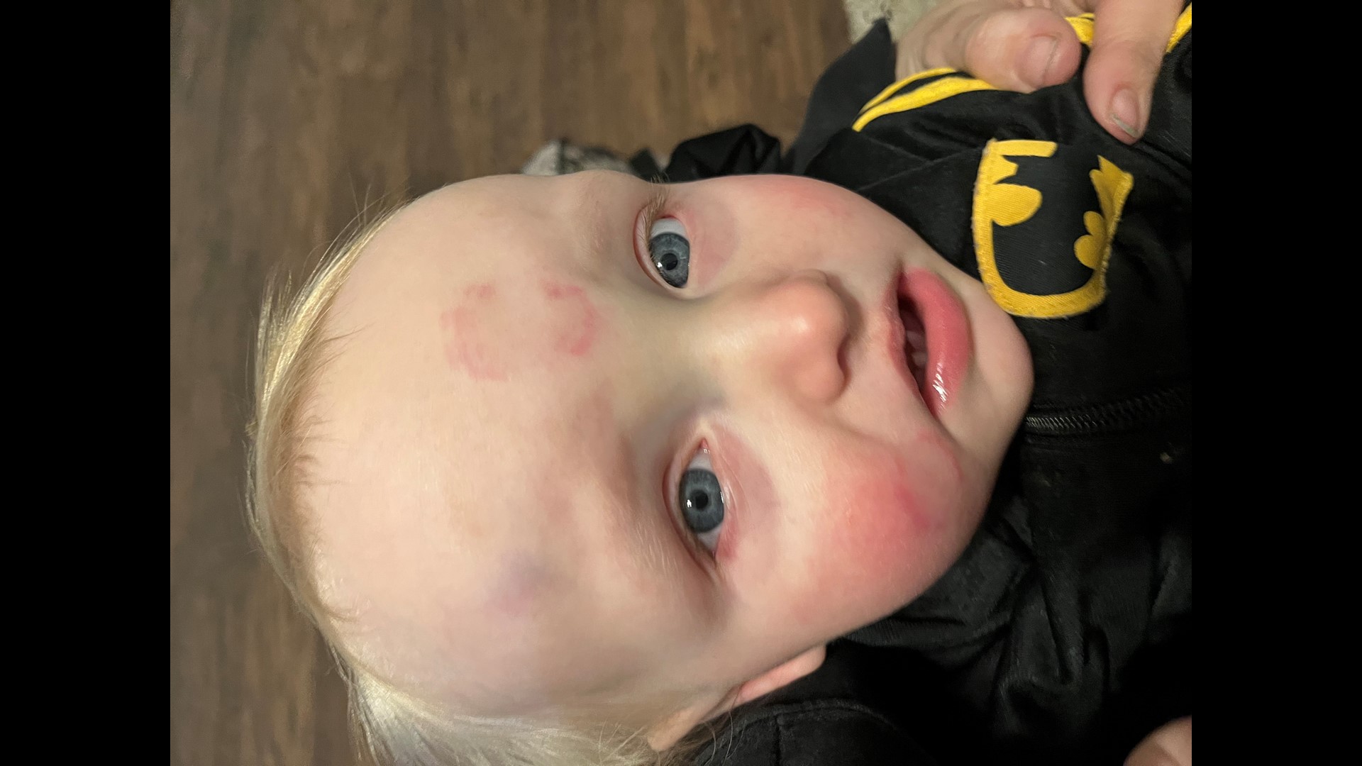 Daycare under investigation after toddler was bitten: Clayton Co ...
