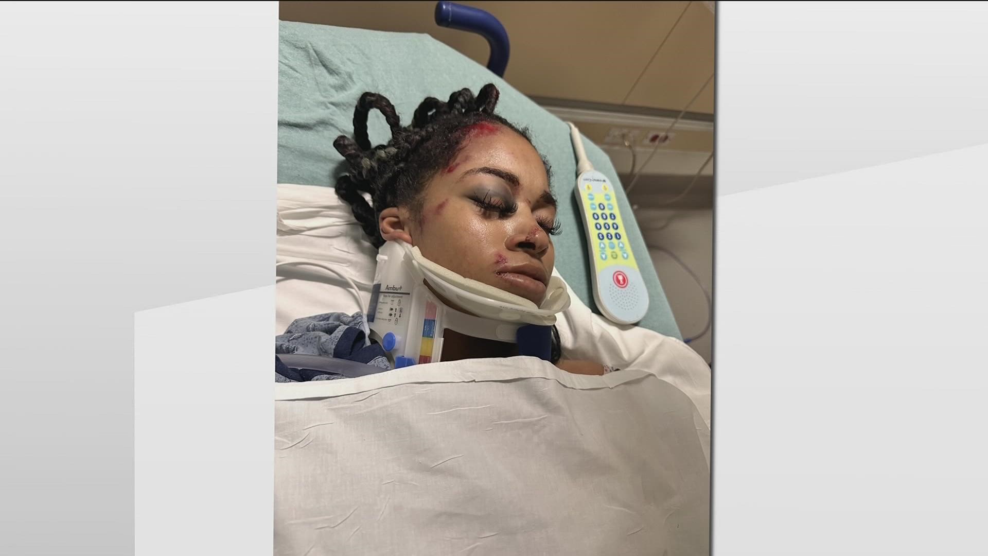 'Knocked unconscious Delta worker hit by truck at Atlanta airport ...