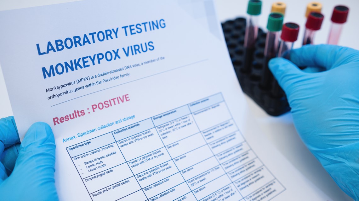 Monkeypox testing sites in Georgia | Where to get tested | 11alive.com