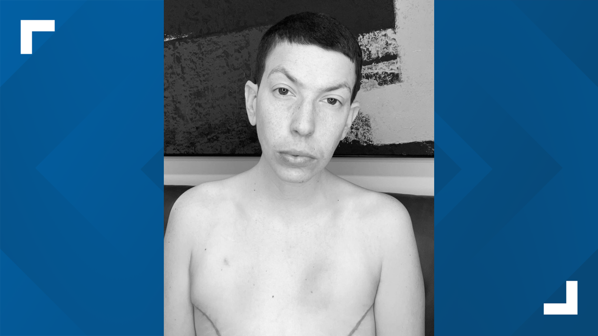 Lindzey Schaffer: Skateboarder, cancer survivor, TikTok star | 11alive.com