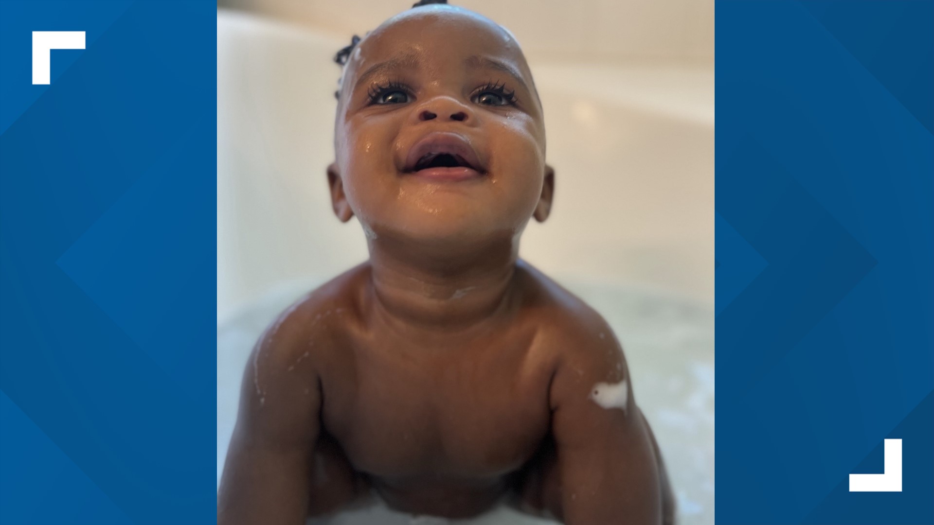 Amahd Black Georgia baby badly burned in freak accident | 11alive.com
