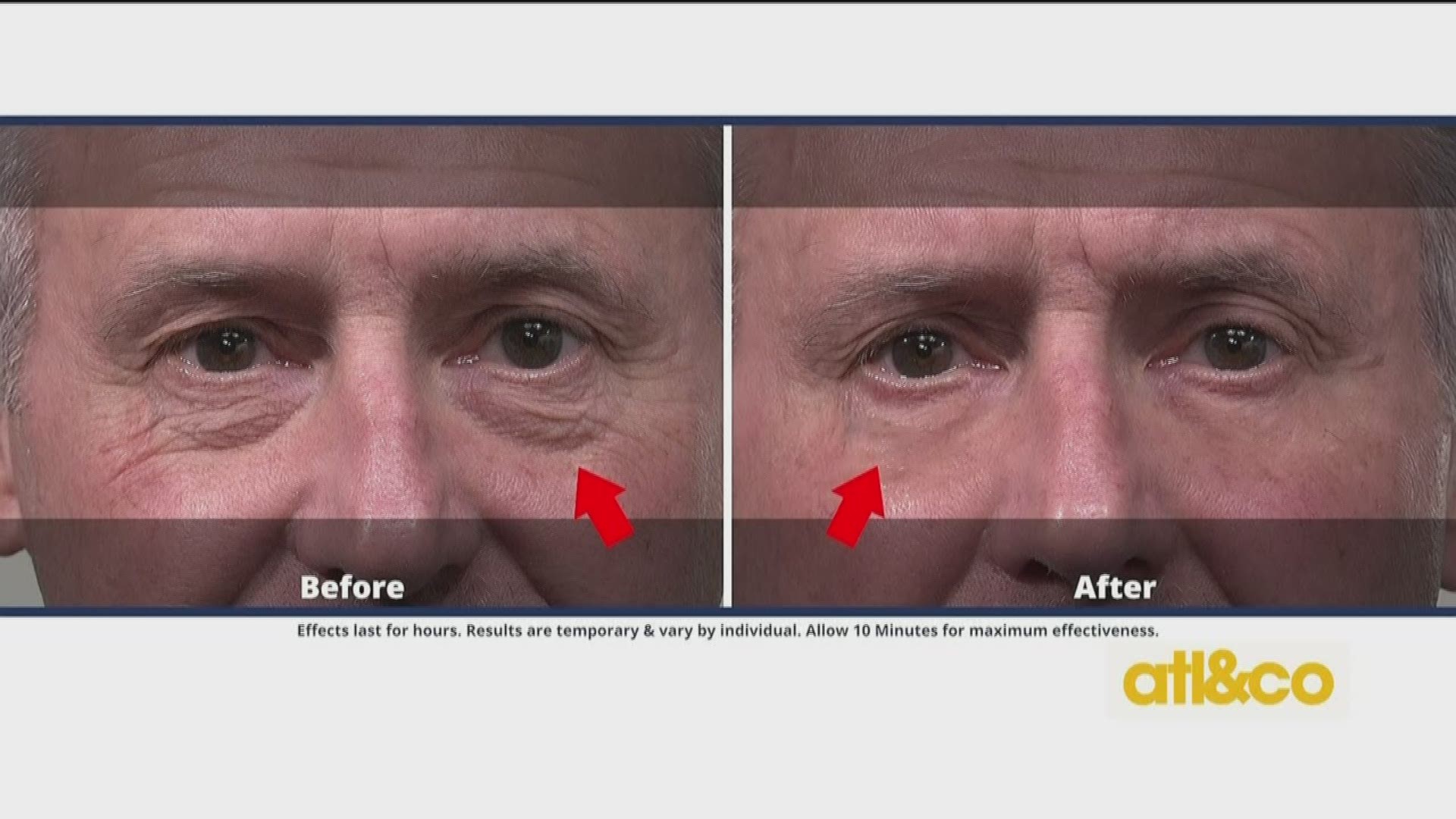 Plexaderm Skincare | 11alive.com