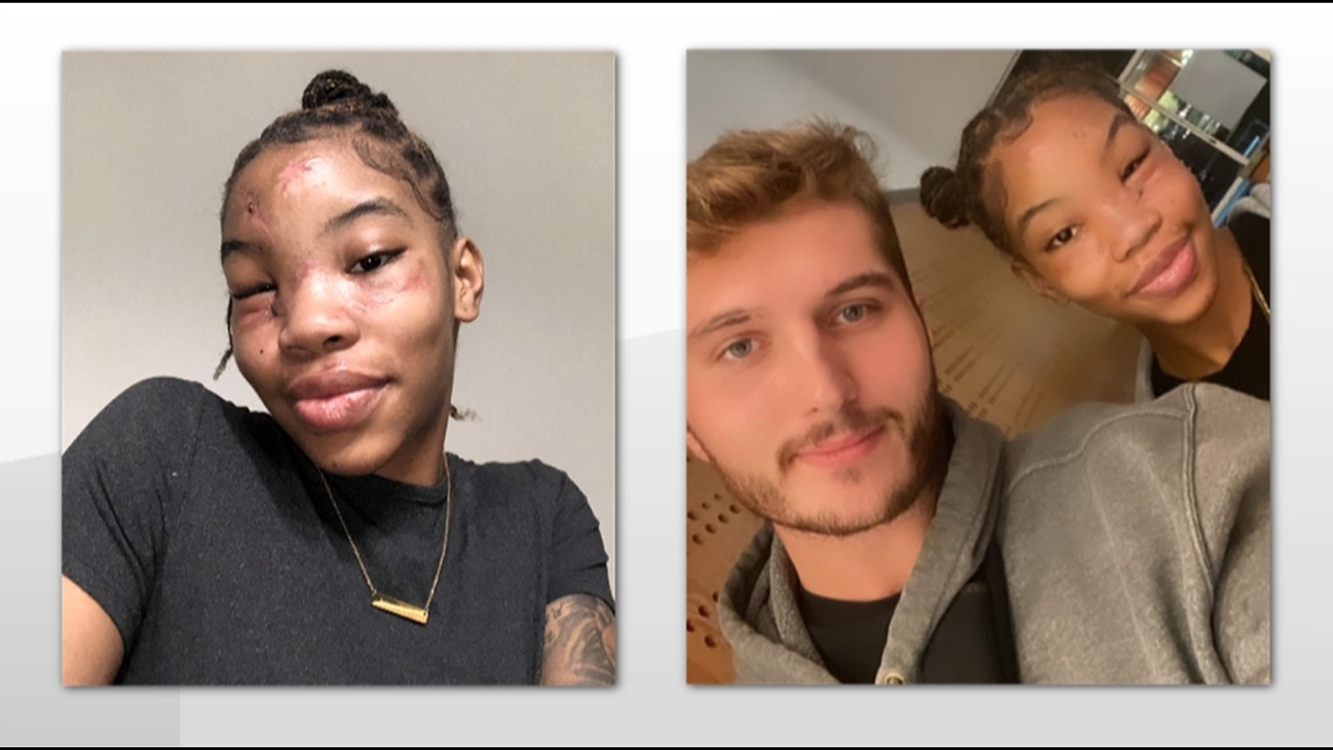 Couple survives waterfall accident, boyfriend fights cancer | 11alive.com