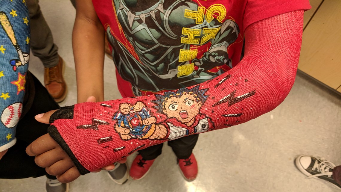 Local artists personalize casts, prosthetics for Children's patients ...