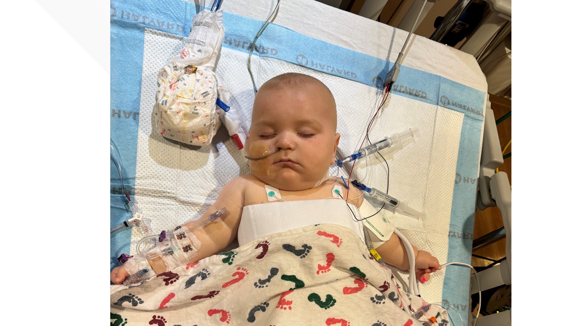 Dad gifts baby with kidney transplant | 11alive.com