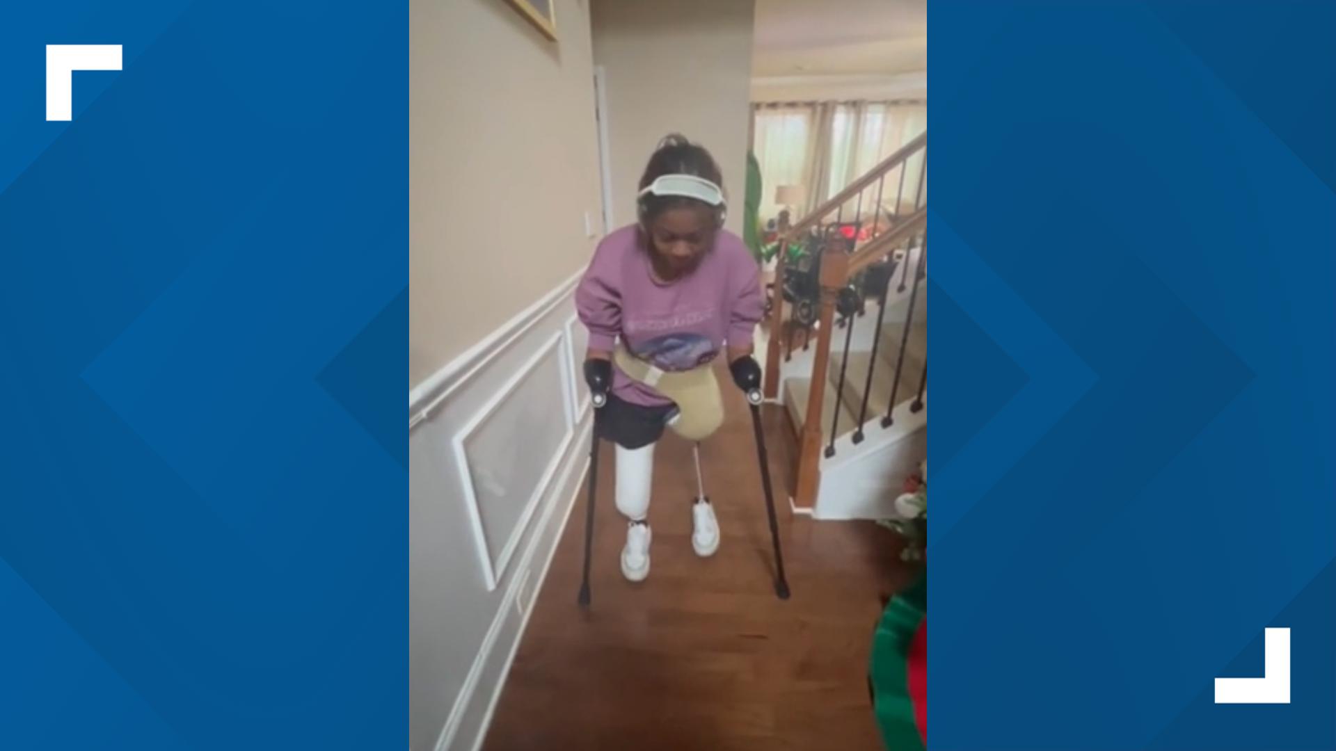 She lost her arms and legs now she is walking again | 11alive.com