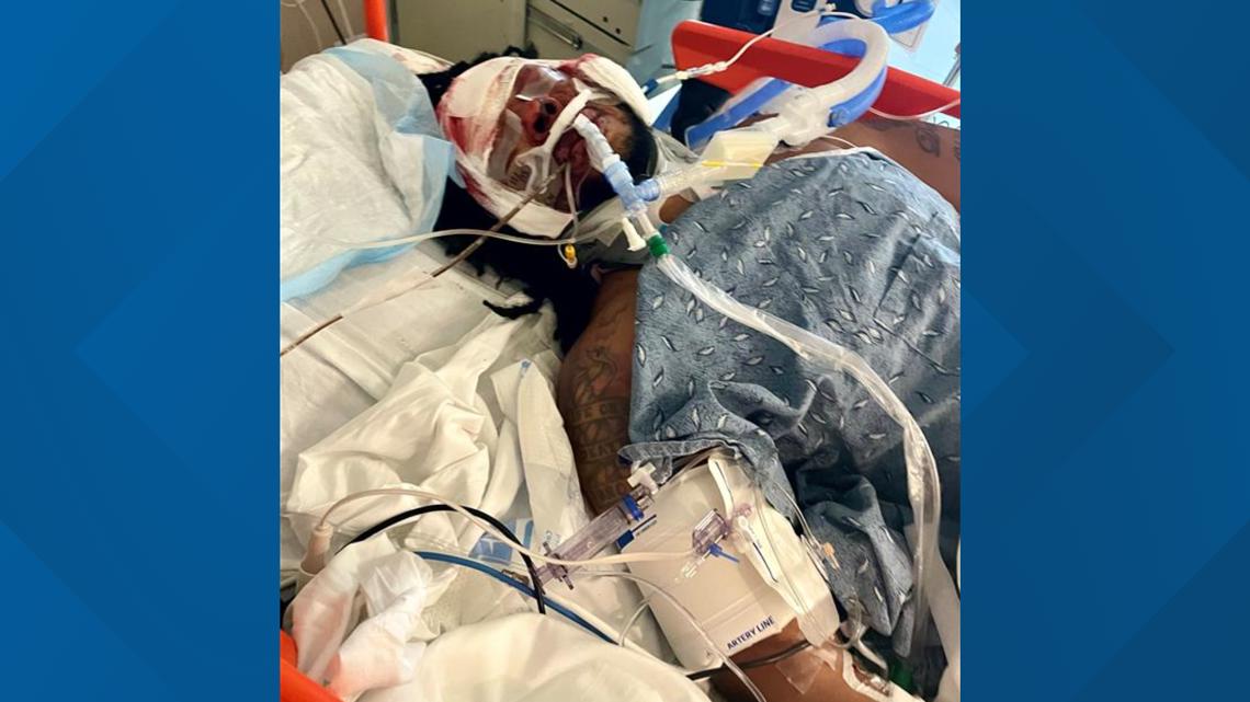 Henry County veteran fighting to recover after hit-and-run on I-75 ...