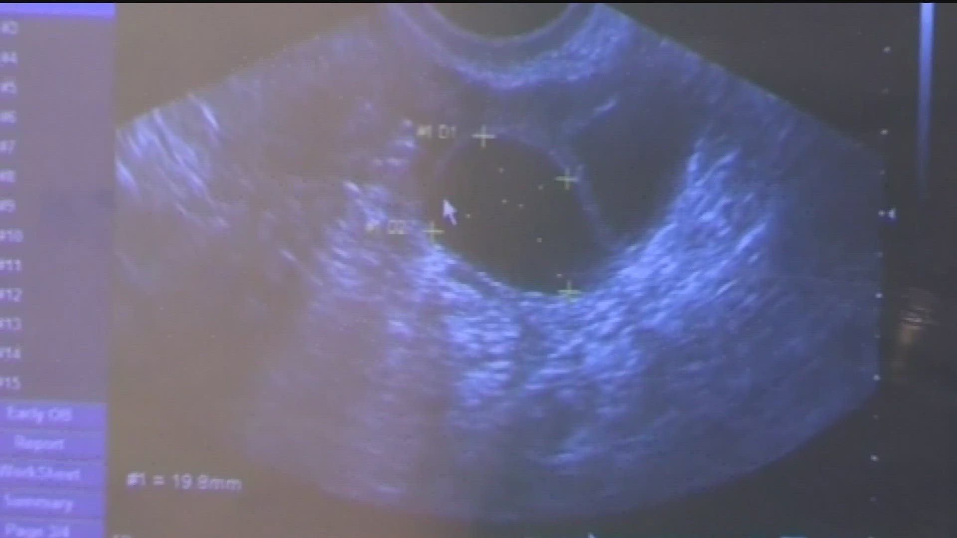 Atlanta adds formerly incarcerated persons as protected class | 11alive.com