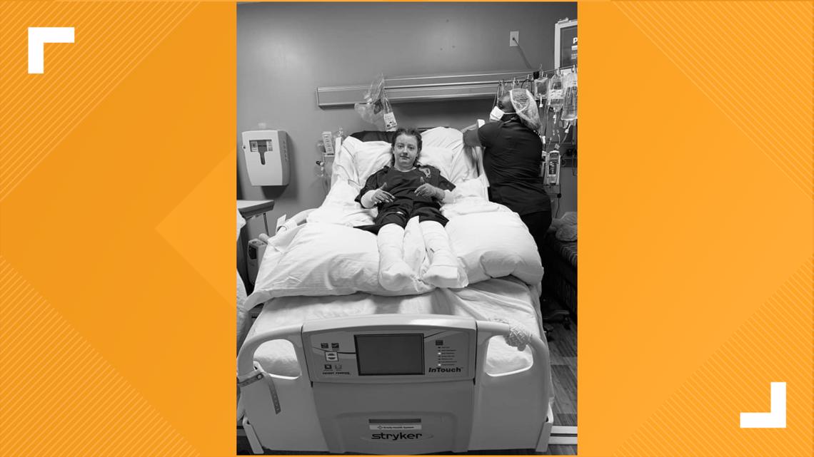 Lake Lanier boat explosion victim Taylor Coleman takes first step ...