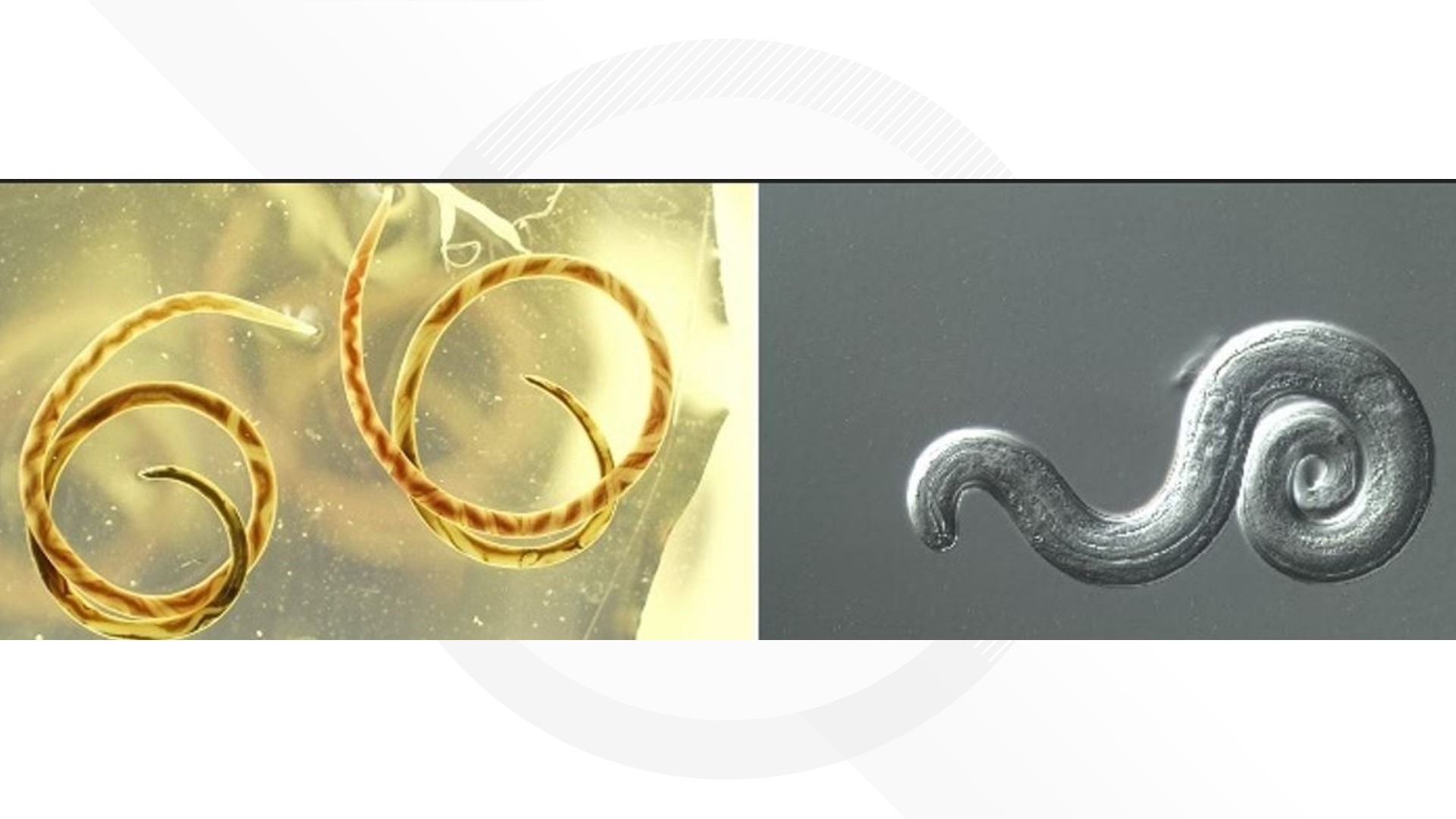 Rat lungworm found in Atlanta | Angiostrongylus cantonensis | 11alive.com