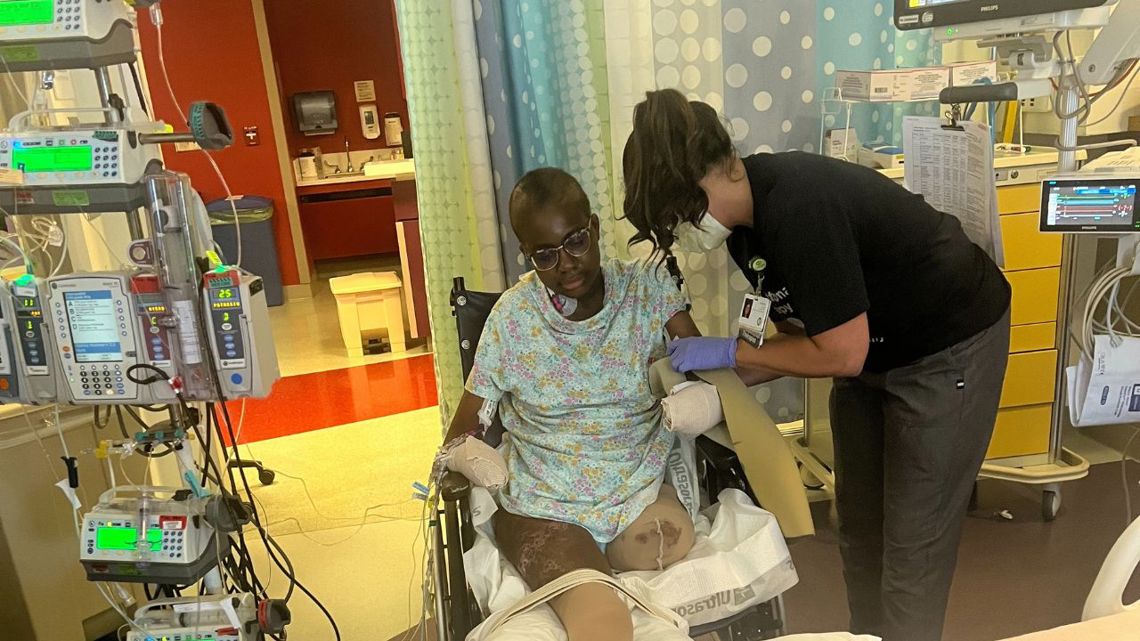 Georgia teen loses four limbs then returns to prom as queen | 11alive.com