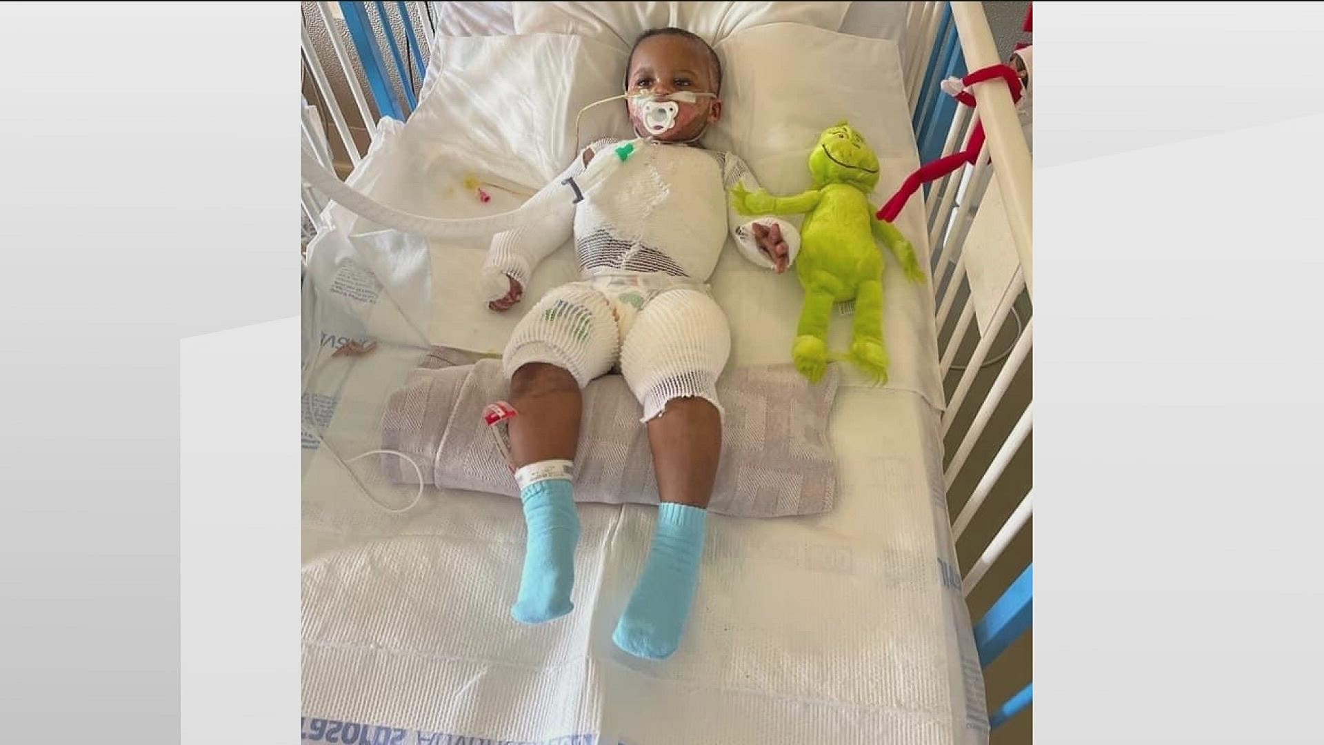 Georgia baby burned in freak accident awake, recognizes parents ...