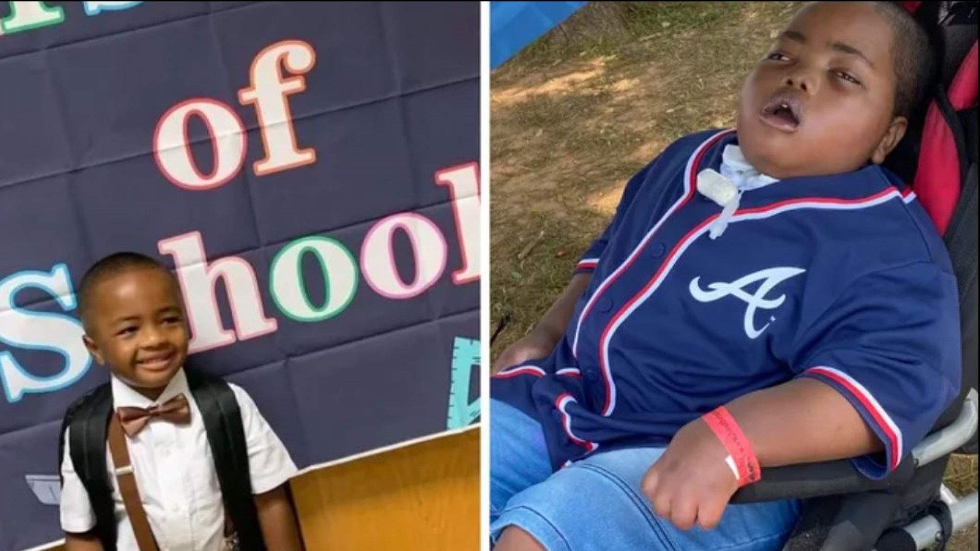 Metro Atlanta boy chokes on grape, suffers severe brain injury ...